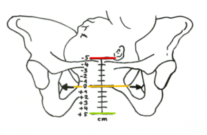 Warum stockt meine Geburt? | Geburt in Eigenregie